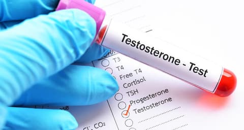 Poziom testosteronu - jak się zmienia? | Diag.pl